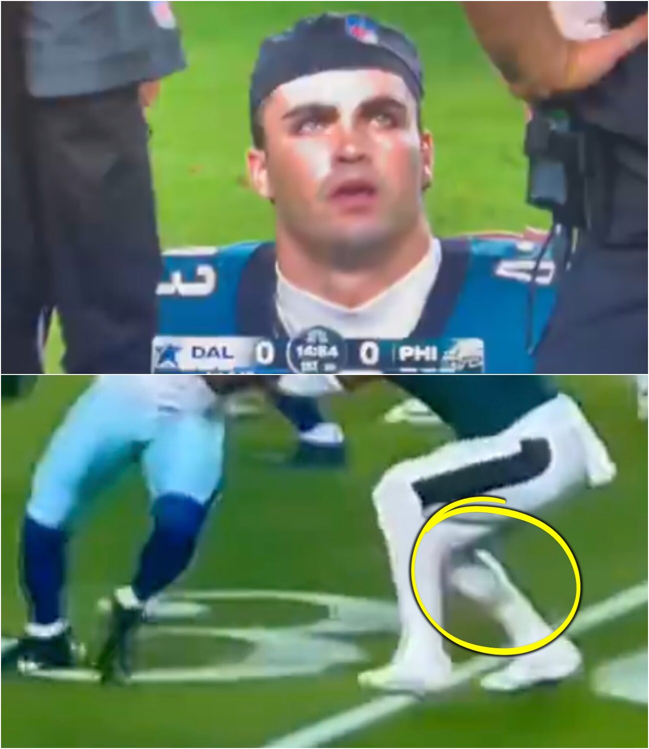 Zoomed-In Slow-Motion Video Shows Eagles Player’s Leg Blowing Up In ...
