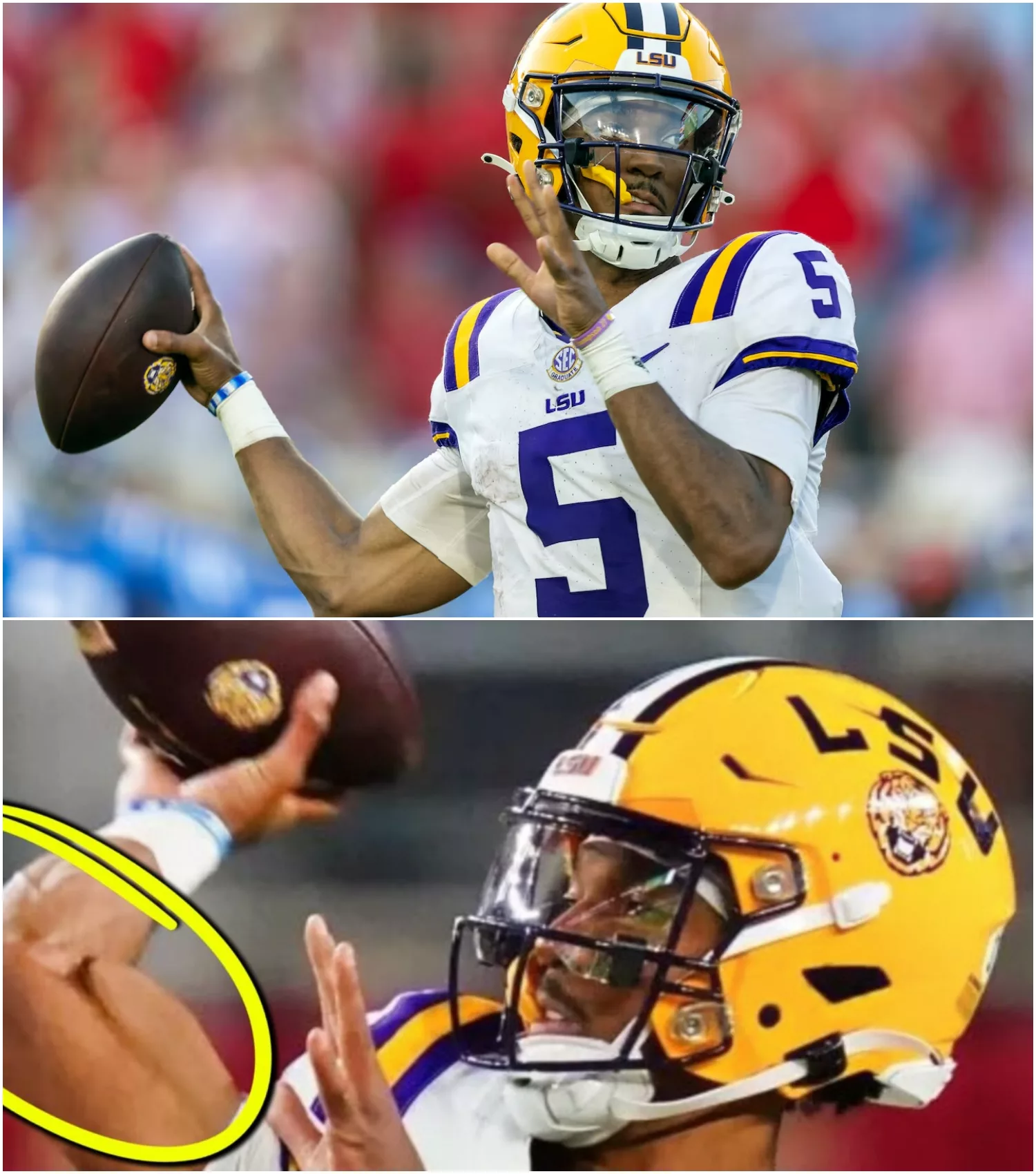 Gruesome Photo Resurfaces Of Jayden Daniels’ Elbow Popping At LSU – Why ...